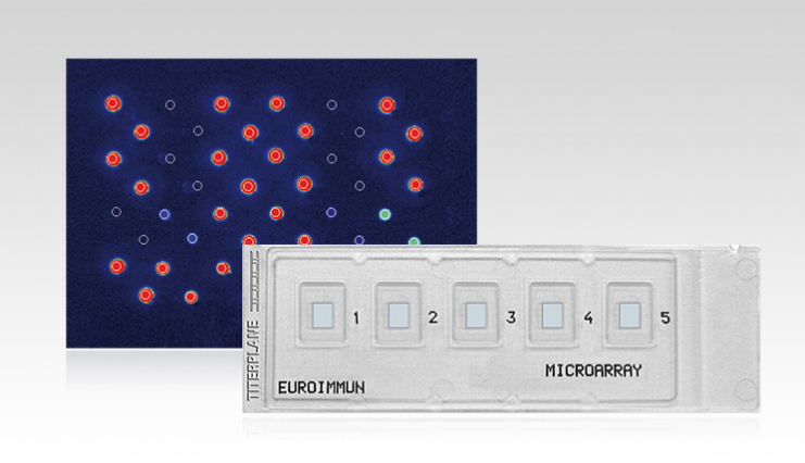 EUROArray HPV test for individual cancer prevention - Euroimmun Blog