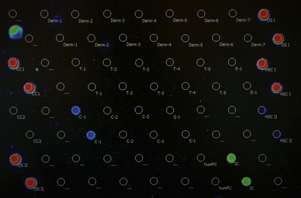 A well-travelled fungus - Euroimmun Blog