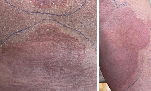 A gift from the heavens - Euroimmun Blog