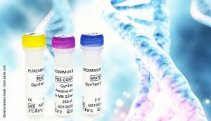 Products Archive - EUROIMMUNBlog