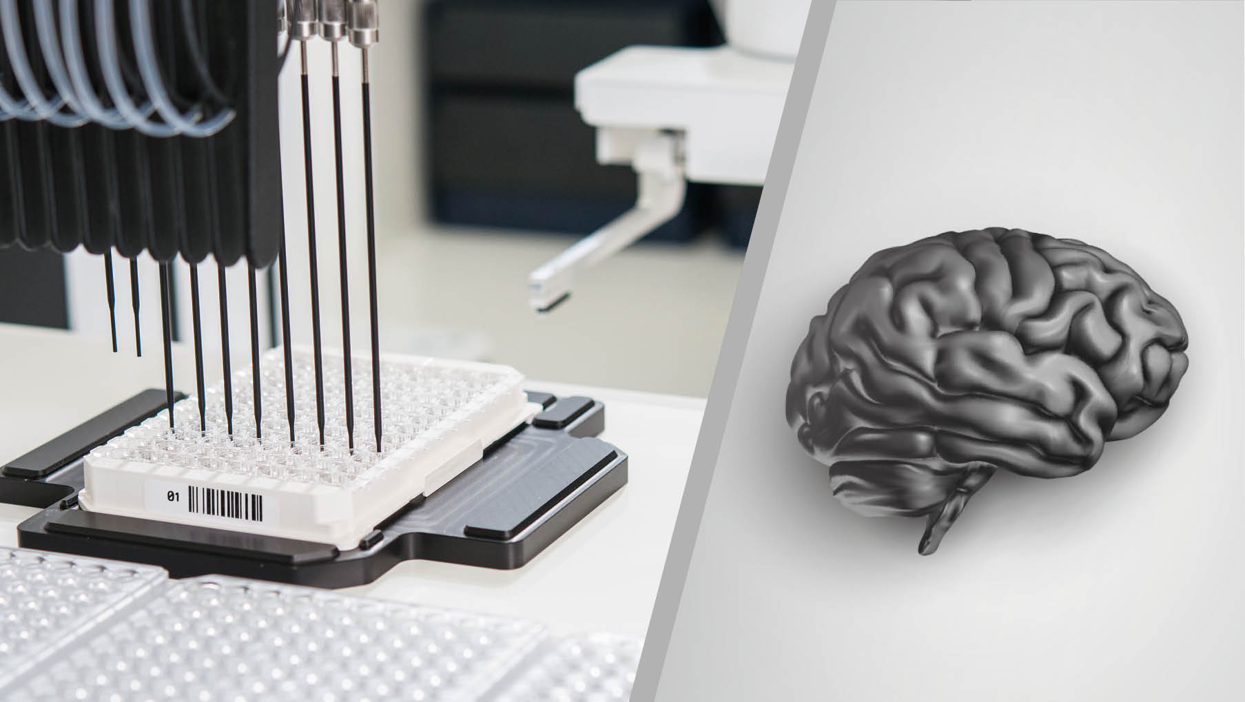 The new generation of CSF ELISAs - Euroimmun Blog