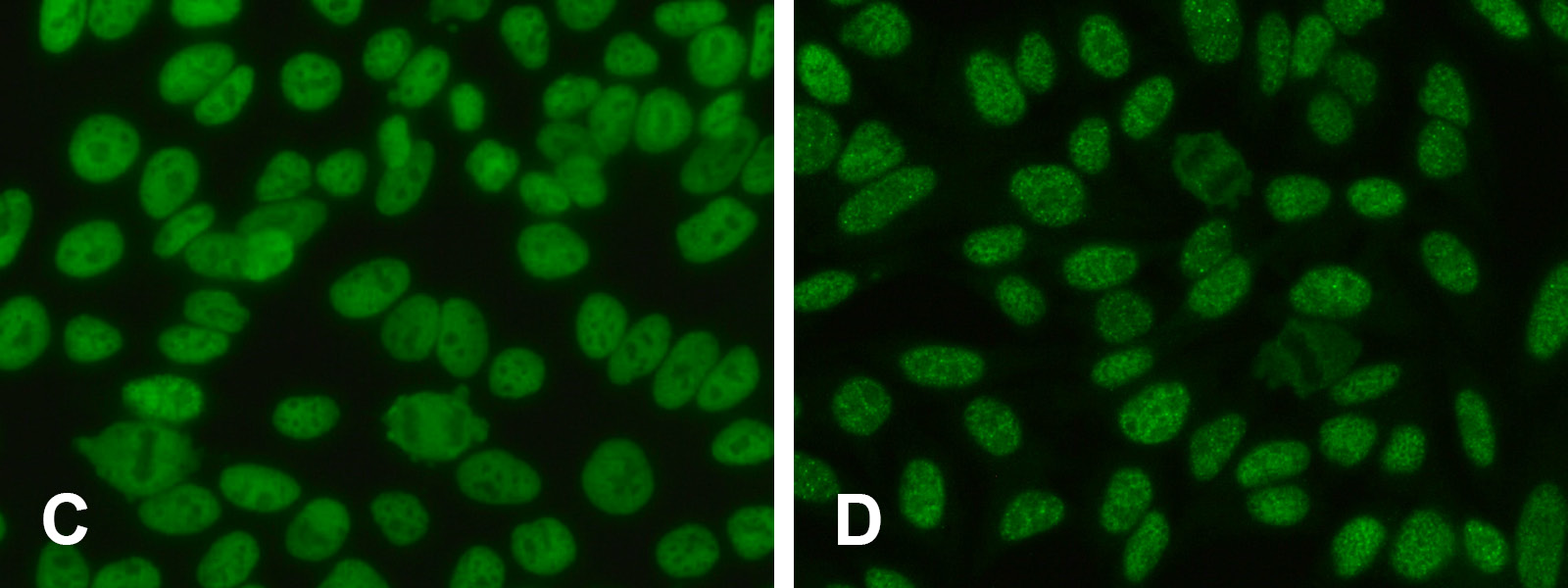 New patterns in ANA diagnostics - Euroimmun Blog